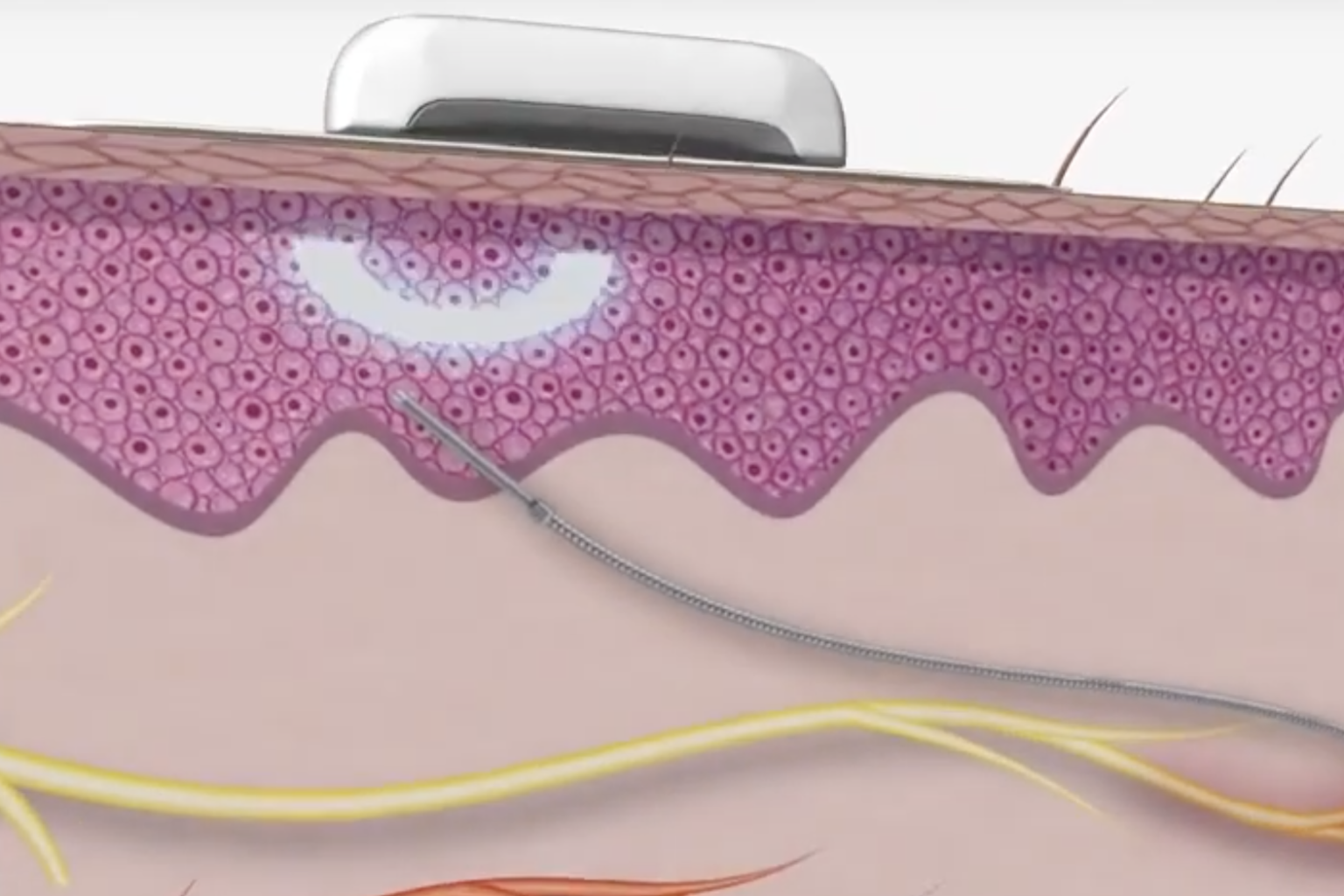 PNS - Praxis Dr. Ibrahim & Kollegen - Regionales Schmerzzentrum DGS ...